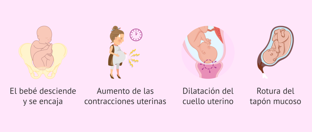 Guía completa sobre el parto inducido: todo lo que debes saber - INFANT ...